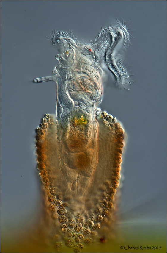 A few oldies. Amoeba, suctorian and two rotifers. - www ...