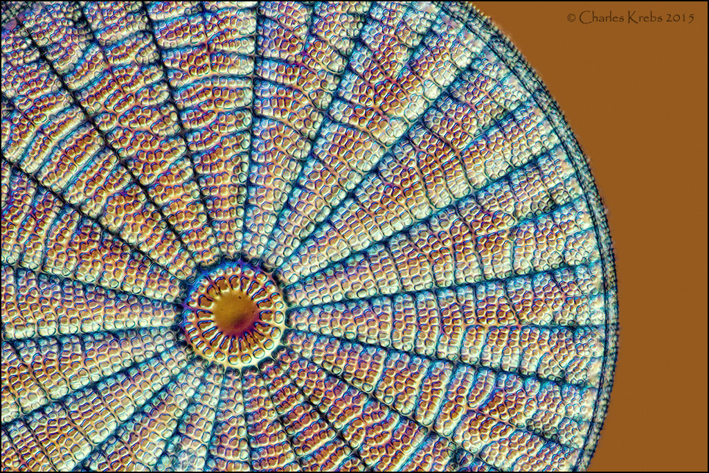 Arachnoidiscus ornatus - www.photomacrography.net