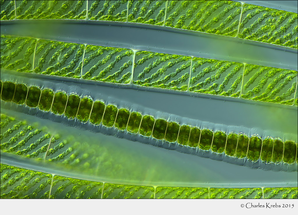 Spirogyra Under Compound Microscope