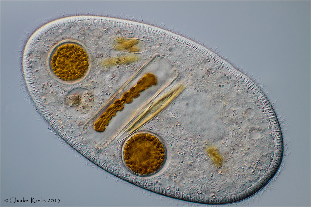 Ciliates Under Microscope