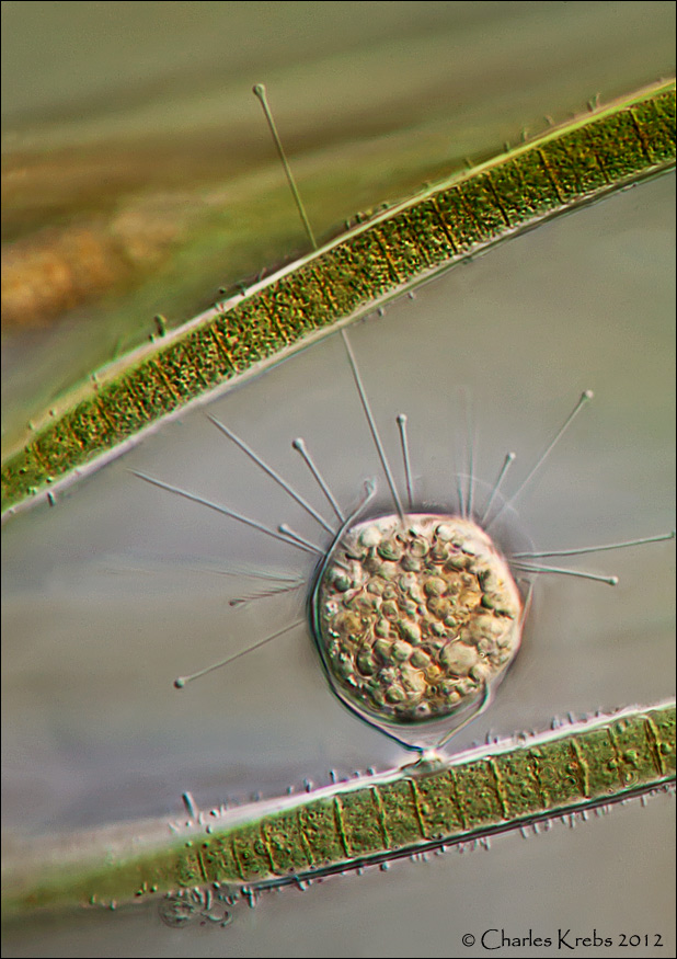 A few oldies. Amoeba, suctorian and two rotifers. - www ...