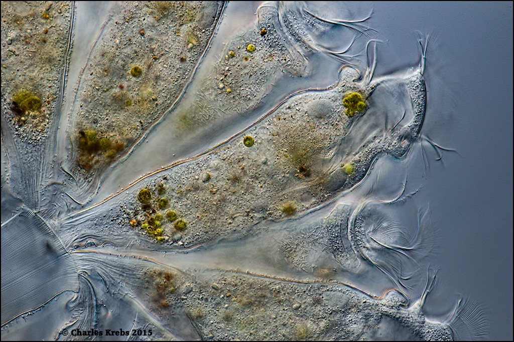 Opercularia or Epistylus (?) and suctorian - www.photomacrography.net