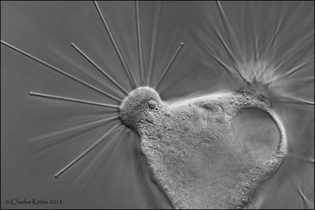 Opercularia or Epistylus (?) and suctorian - www.photomacrography.net