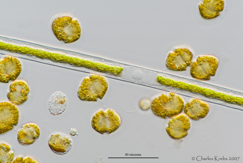 Gymnodinium (a dinoflagellate) - www.photomacrography.net