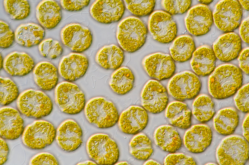 Gymnodinium (a dinoflagellate) - www.photomacrography.net