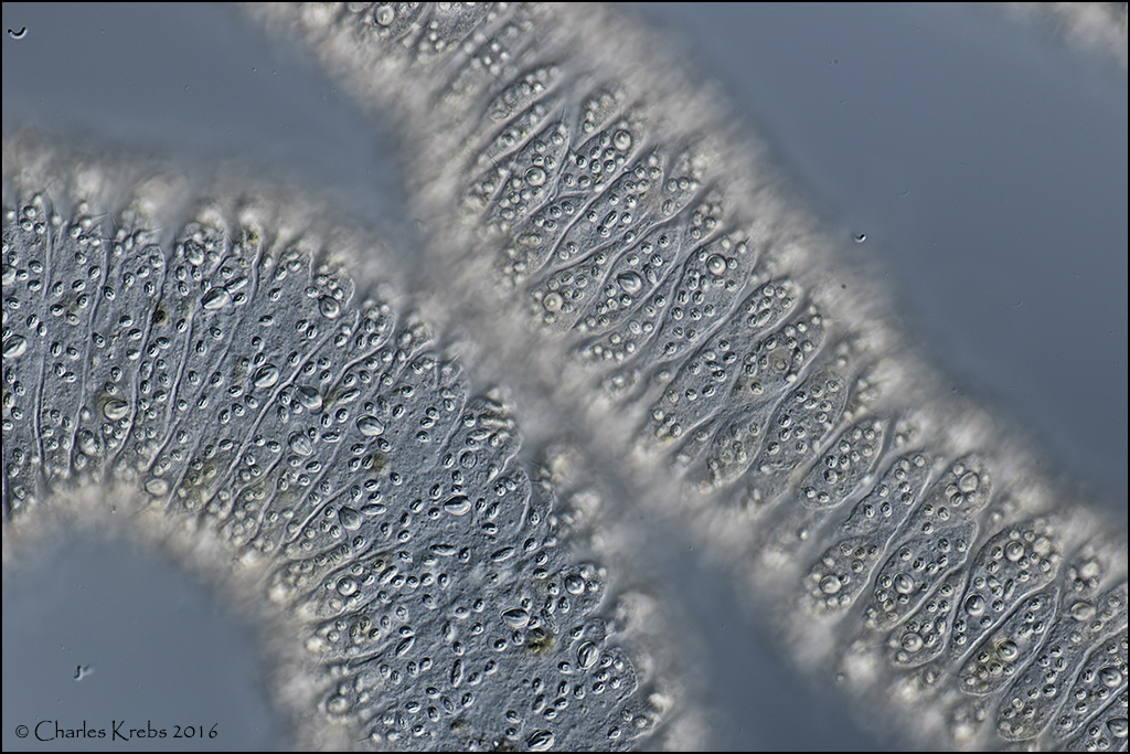 Hydra nematocysts - www.photomacrography.net