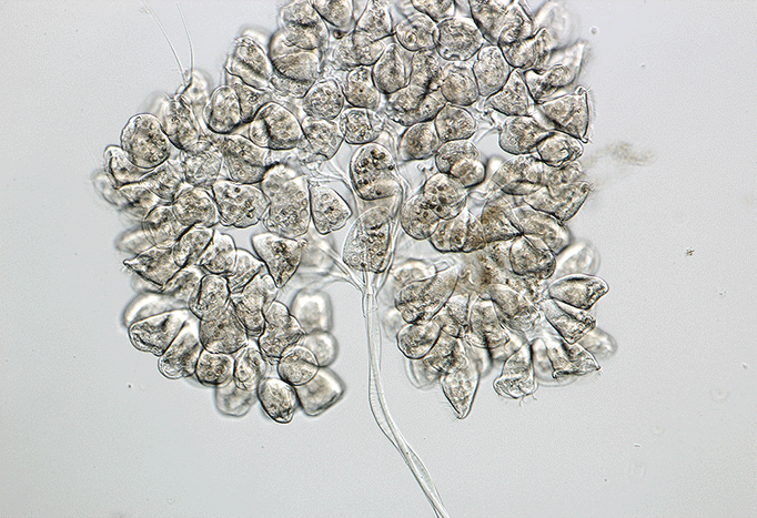 Carchesium. Actinophrus (heliozoan). - www.photomacrography.net