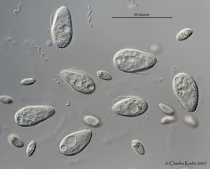 Cyclidium (and other fast moving little critters) - www ...