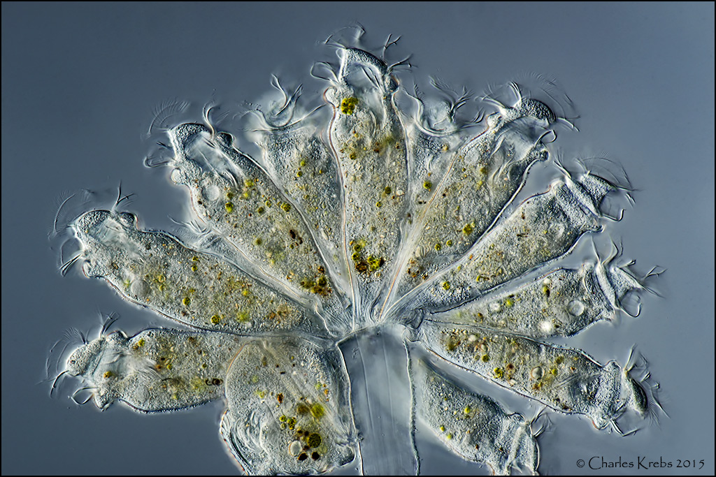 Opercularia or Epistylus (?) and suctorian - www.photomacrography.net